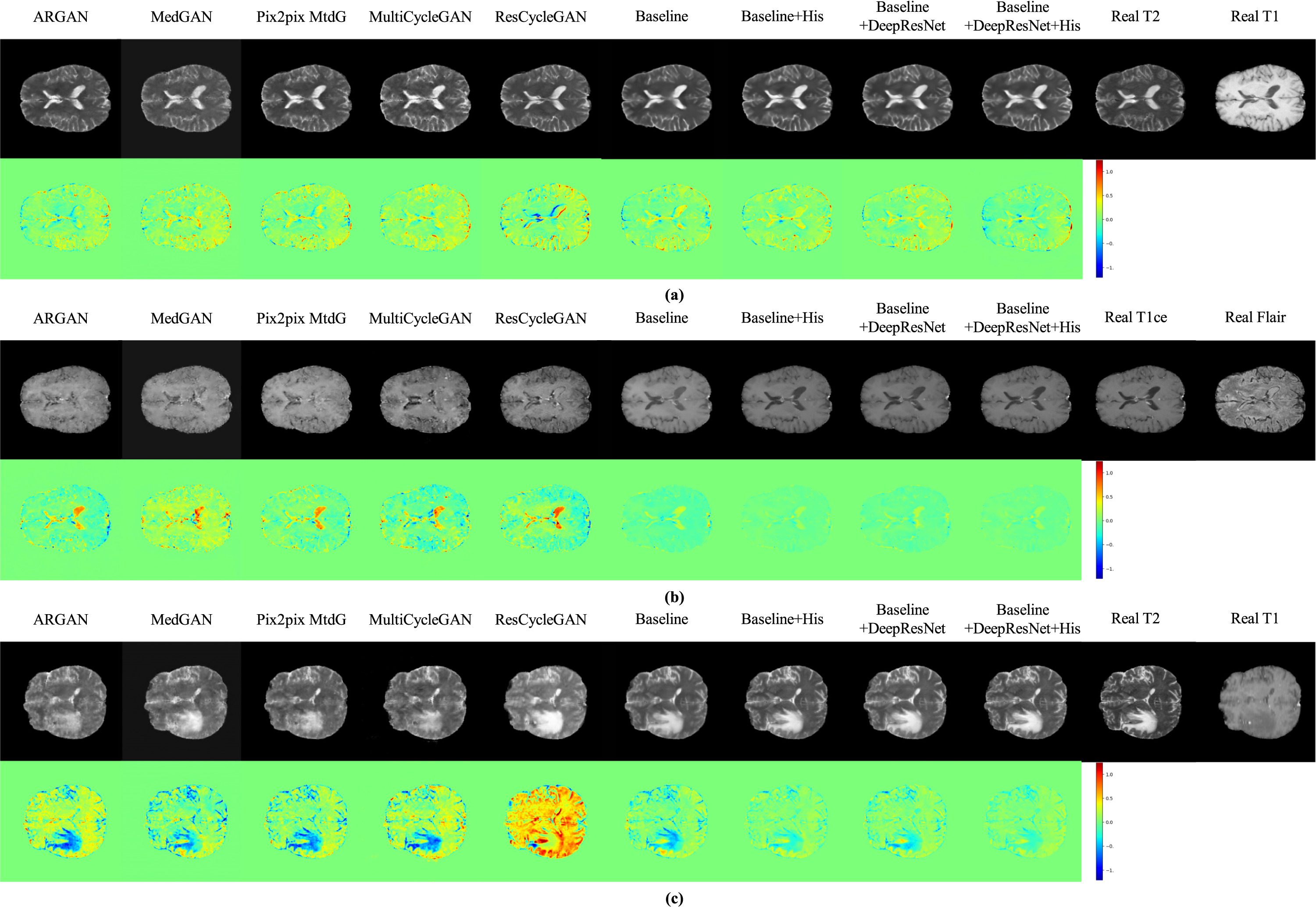 A histogram-driven generative adversarial network for brain MRI to CT ...